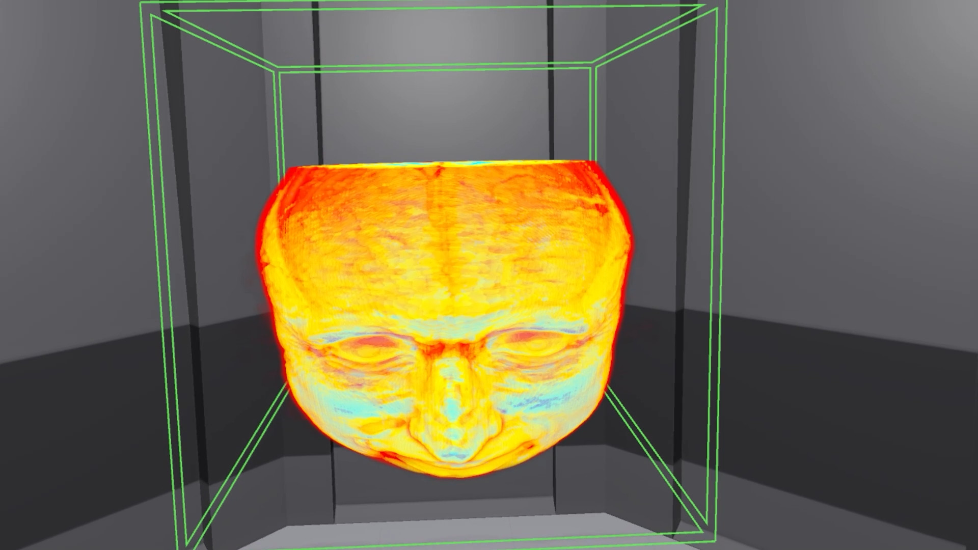 MedicalImagingVR on Steam