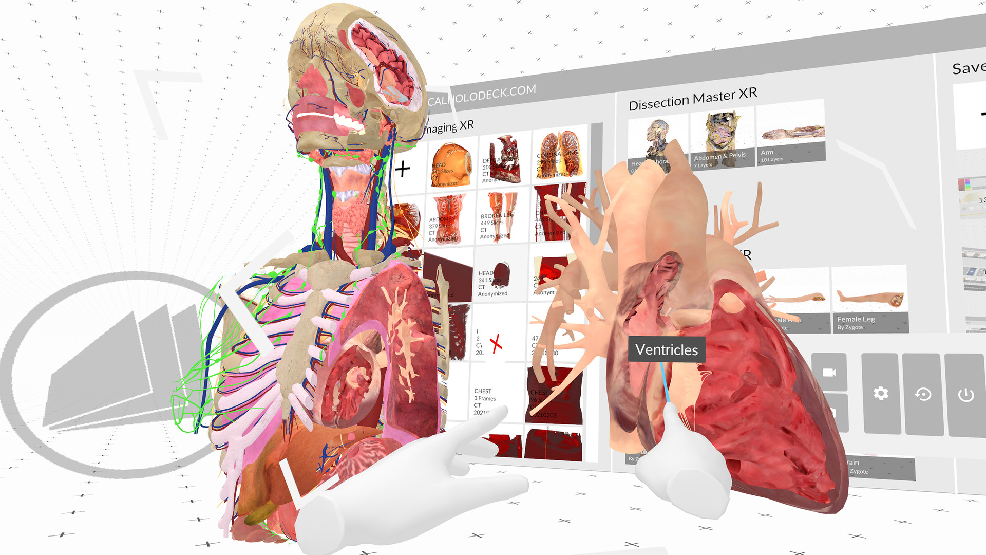 MEDICALHOLODECK. Medical Virtual Reality for 3D Surgical Teaching and Medical Education no Steam