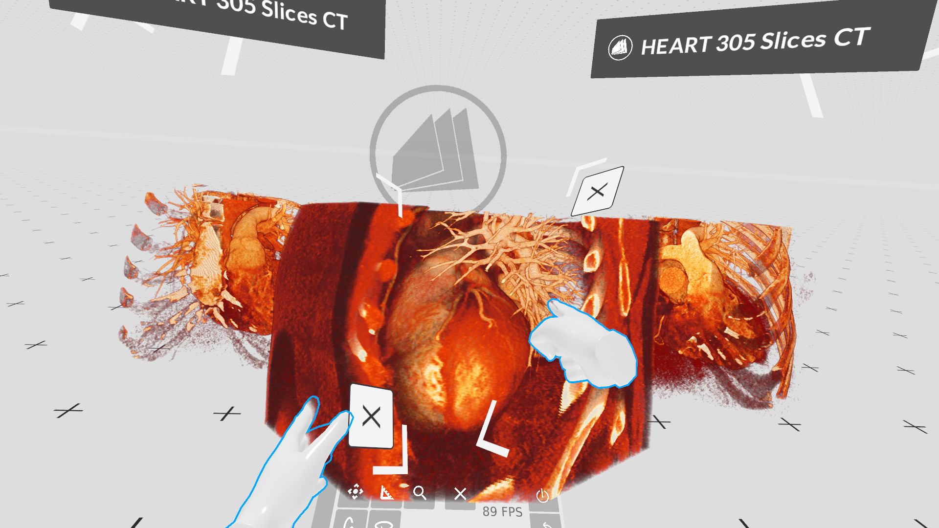 MEDICALHOLODECK. Virtual Reality for Surgical Teaching, Anatomy Training, and Medical Education ...