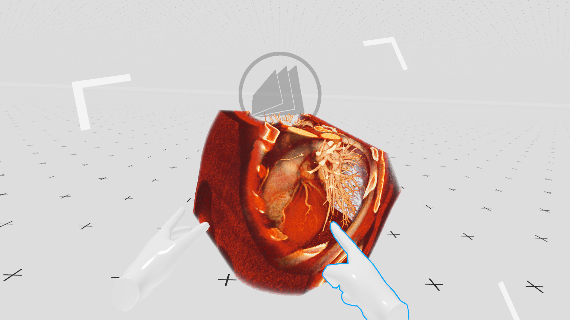 MEDICALHOLODECK. The DICOM Viewer and Human Anatomy Lab in Virtual ...